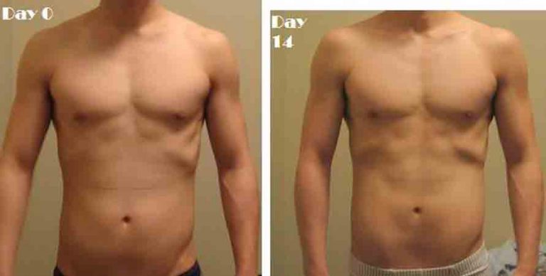 Efeitos Colaterais do Durateston Quais São Eles?